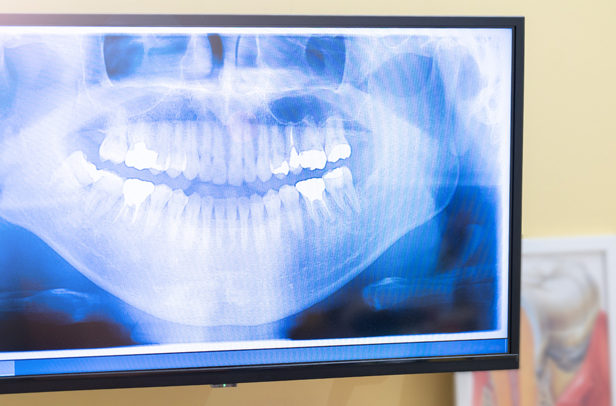 診療の流れ - しまむら歯科